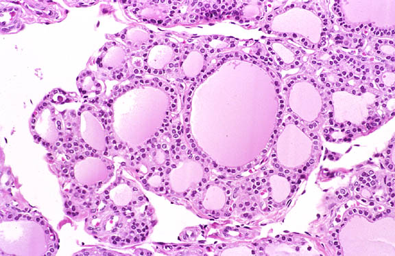 Vairogdziedzera mezgli: iemesli un rīcība to gadījumā — Doctus