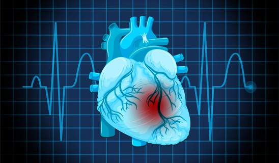 Ātriju fibrilācija jauniem pieaugušajiem — Doctus